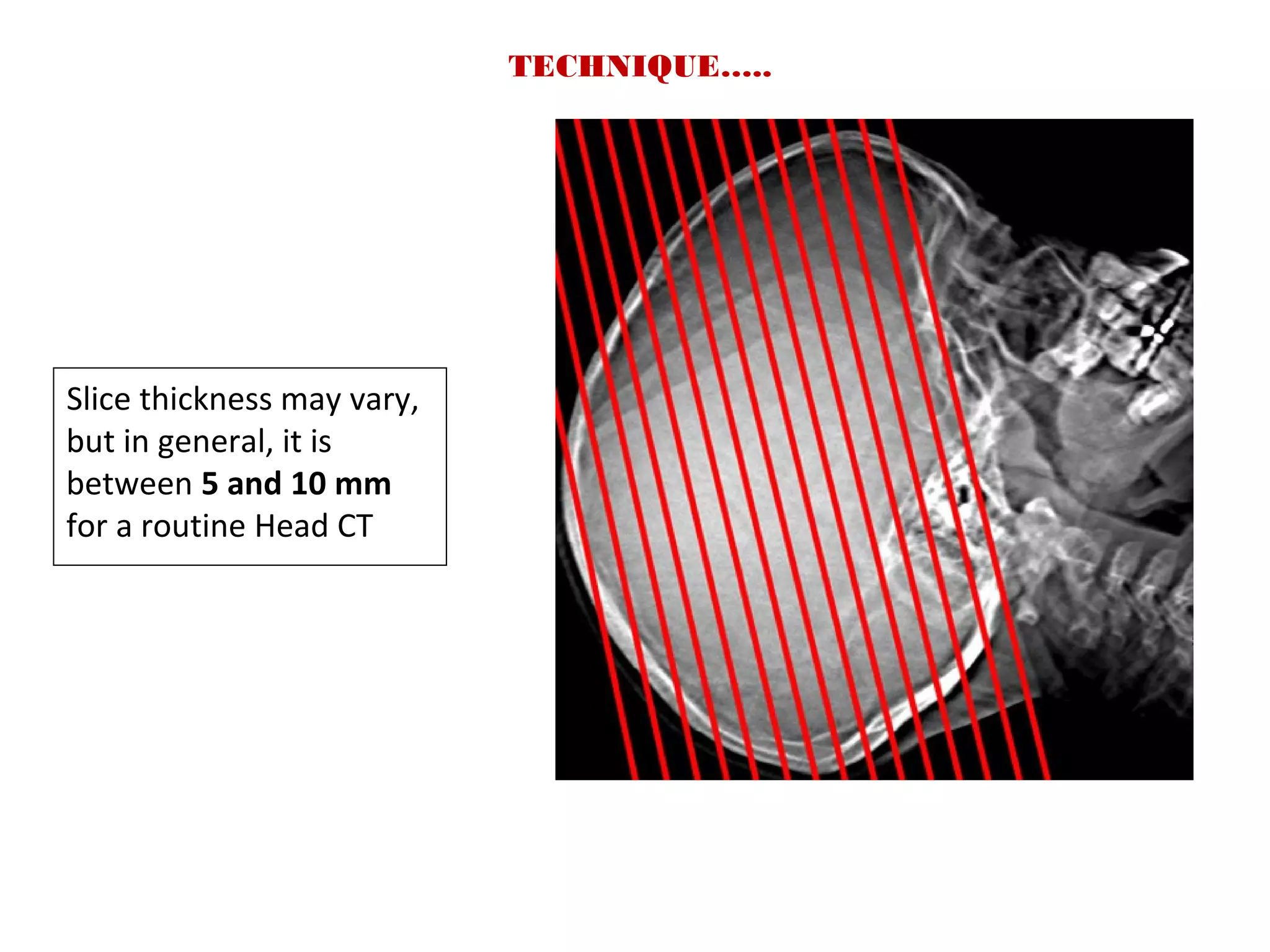 CT Scan Head basics | PPT