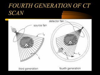 Ct scan by sajid ejaz | PPT