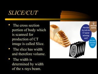 Ct scan by sajid ejaz | PPT