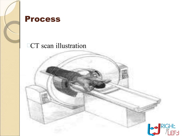 Ct scan and its interpretation in omfs | PPTX | Death, Injury, or ...