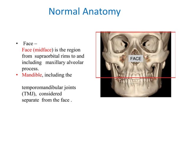 Ct scan and its interpretation in omfs | PPTX | Death, Injury, or ...