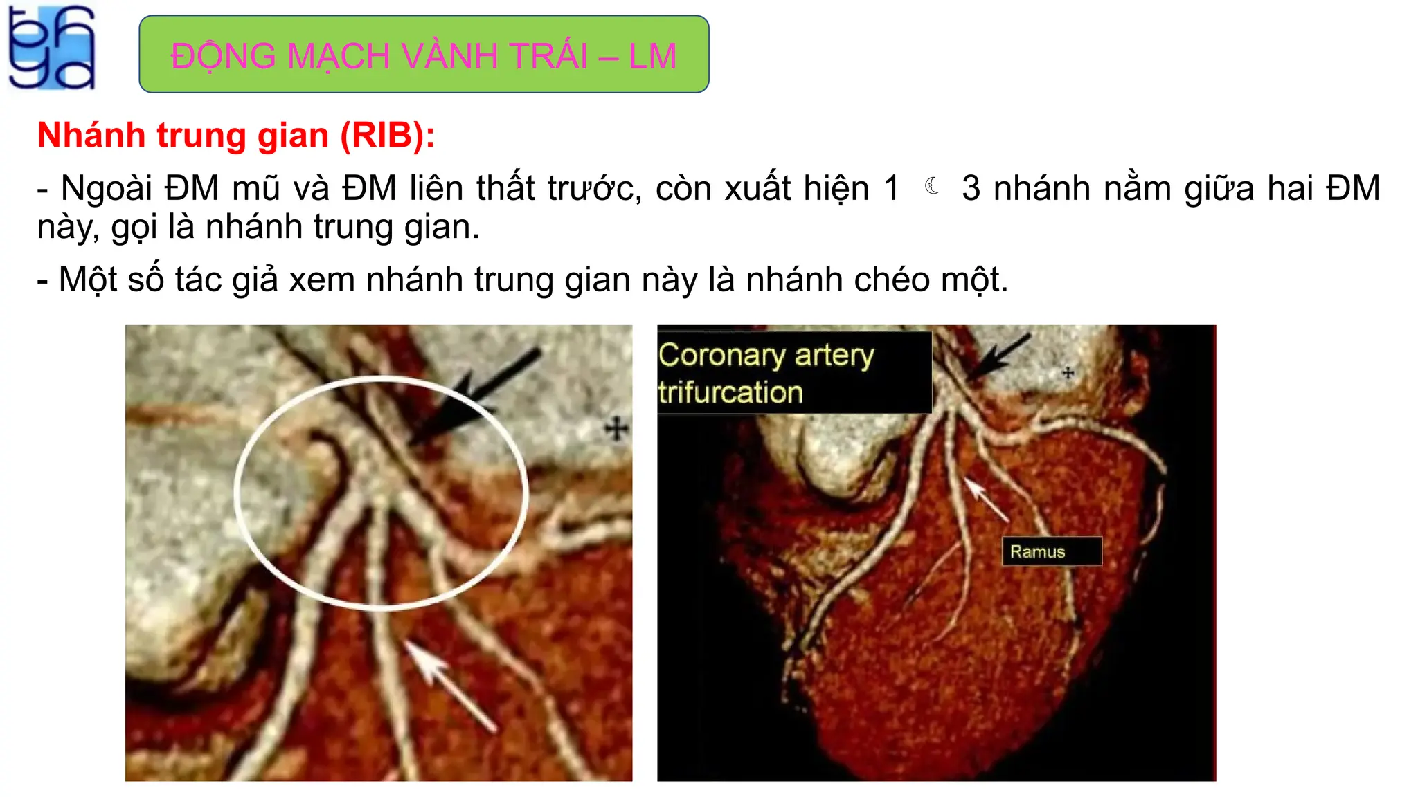 CHUP CAT LOP VI TINH DONG MACH VANH.pptx