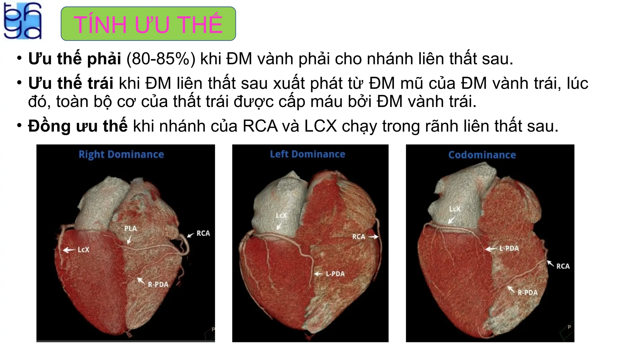 CHUP CAT LOP VI TINH DONG MACH VANH.pptx