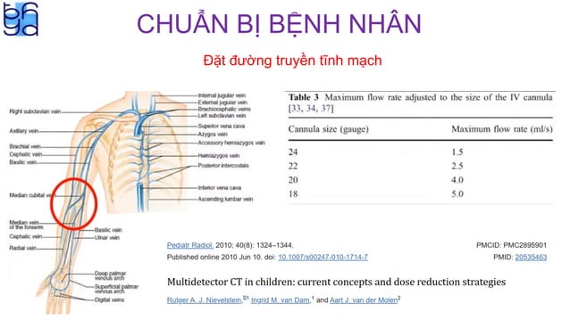 CHUP CAT LOP VI TINH DONG MACH VANH.pptx