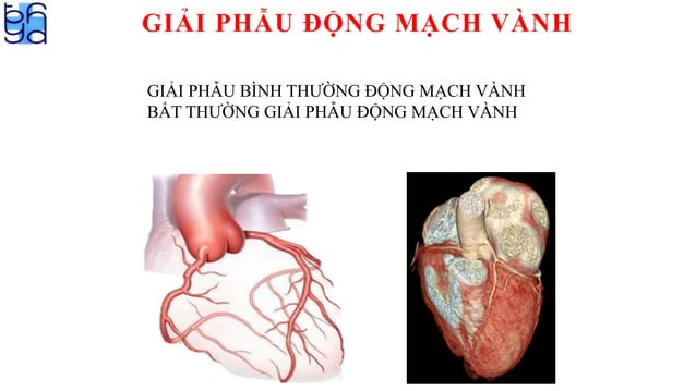 CHUP CAT LOP VI TINH DONG MACH VANH.pptx