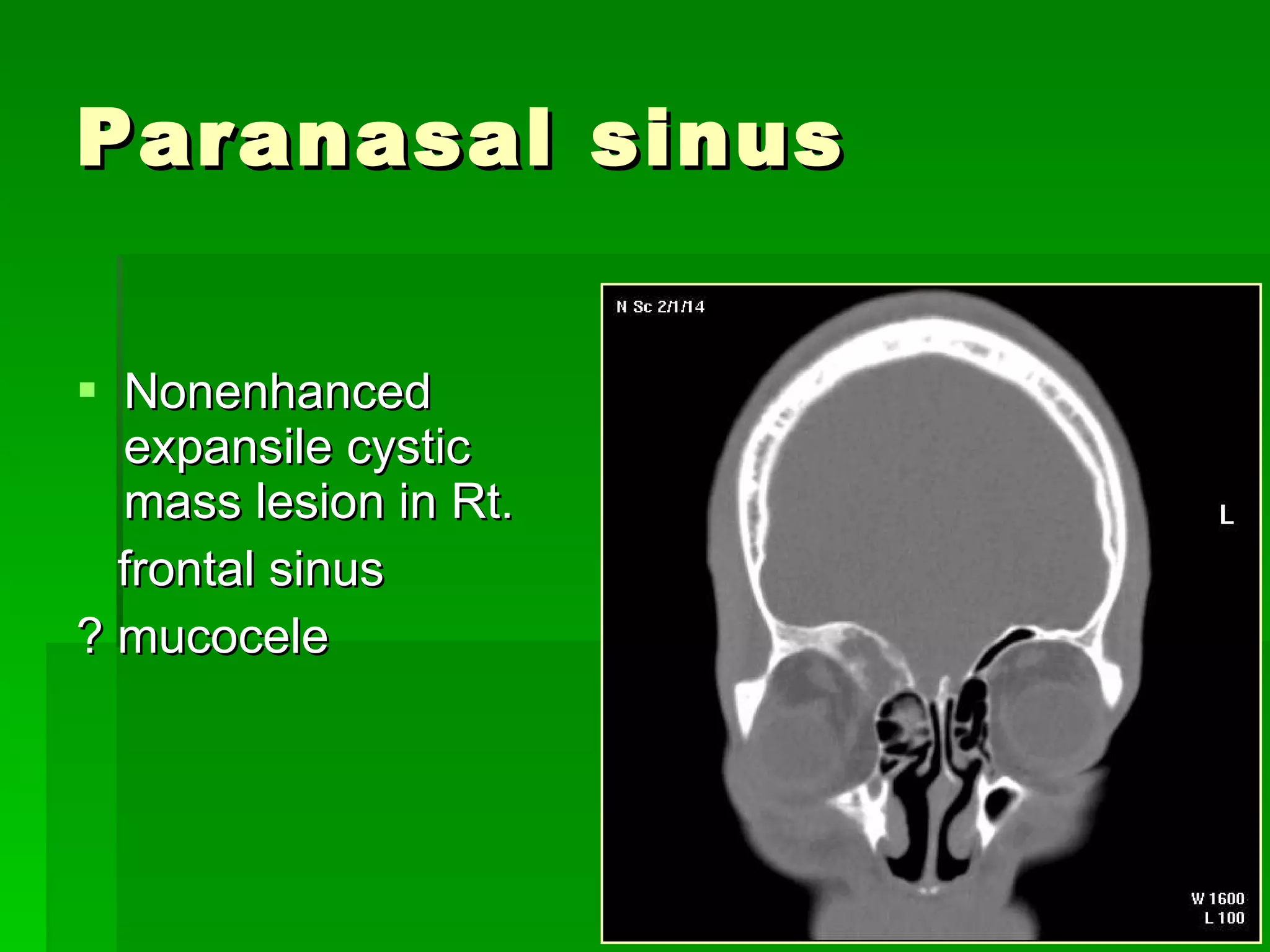 Ct scan eye slide presentation | PPT | Ear, Nose and Throat Conditions ...