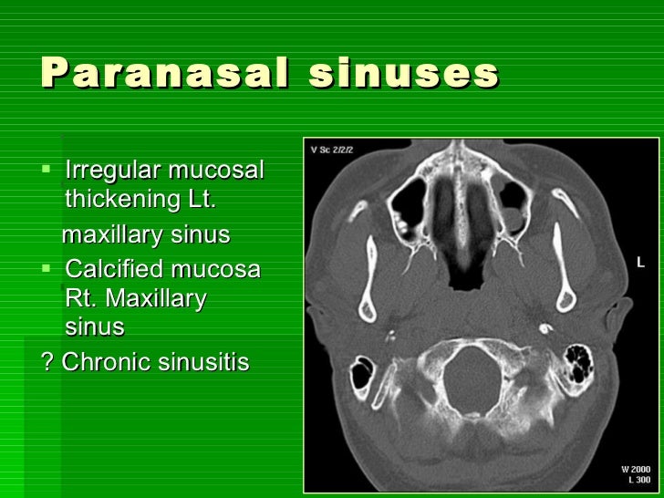 Ct scan eye slide presentation