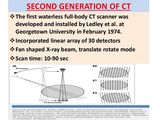 Ct scan final (2)