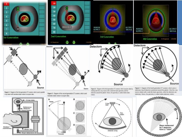 Ct scan final (2)