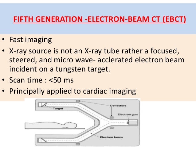 Ct scan final (2)