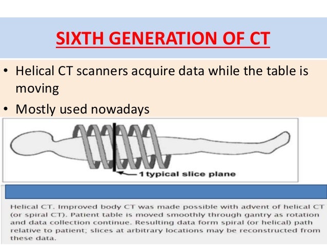 Ct scan final (2)