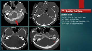 Ct scan in head and spine injuries | PPTX