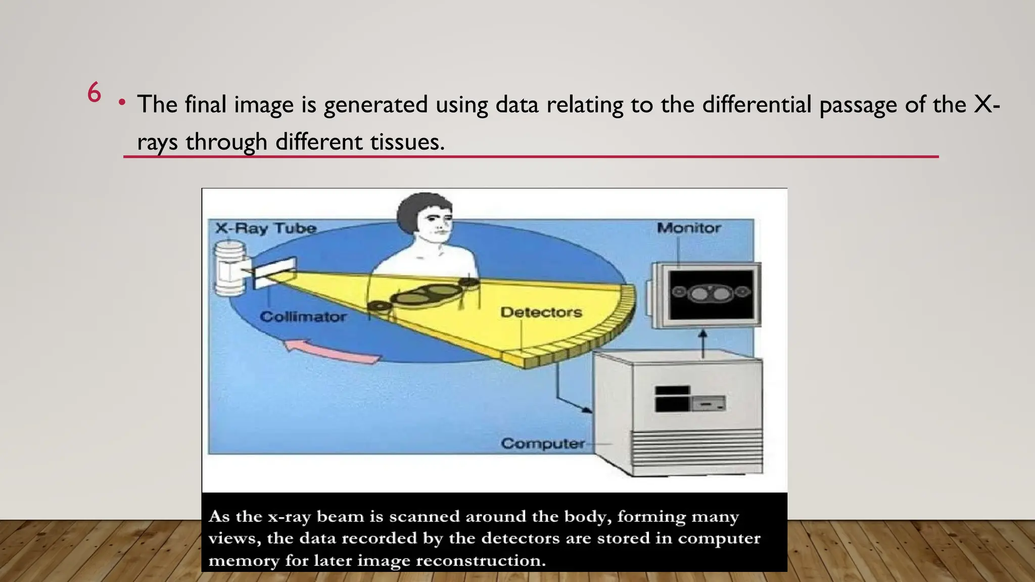 Ct scan in ophthalmology.pptx very important | PPTX