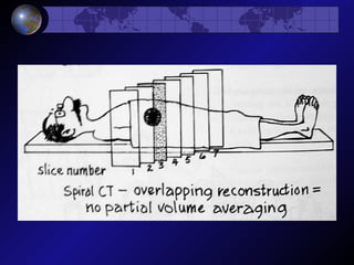 ALAT _ CT _ SCAN _ INTRODUKSI _ ppt .ppt