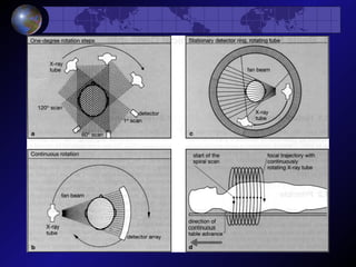 ALAT _ CT _ SCAN _ INTRODUKSI _ ppt .ppt