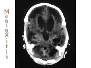Ct scan kepala | PPT