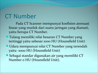 Ct scan kimnal presentation | PPT