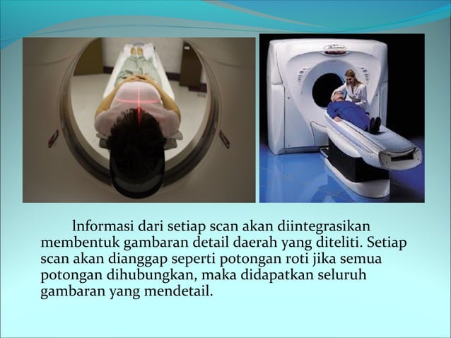 Ct scan kimnal presentation | PPT