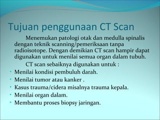 Ct scan kimnal presentation | PPT