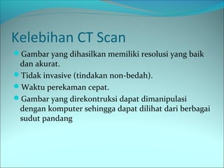 Ct scan kimnal presentation | PPT