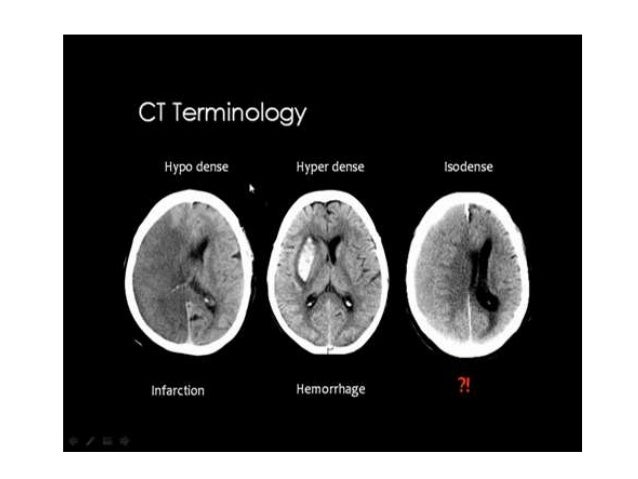 Ct scan brain lecture by rashimul haque rimon