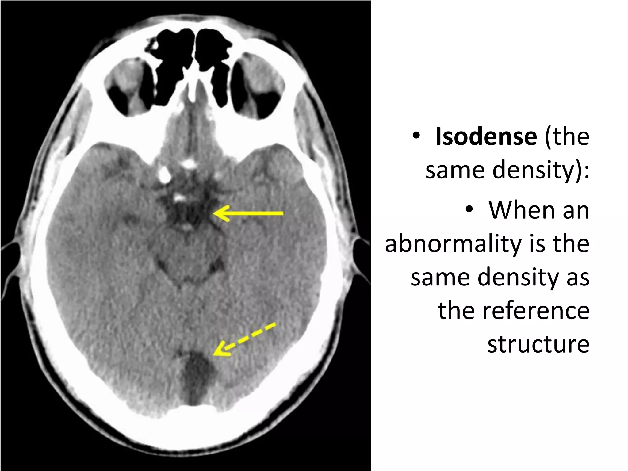 Abdominal CT scan made easy | PPTX