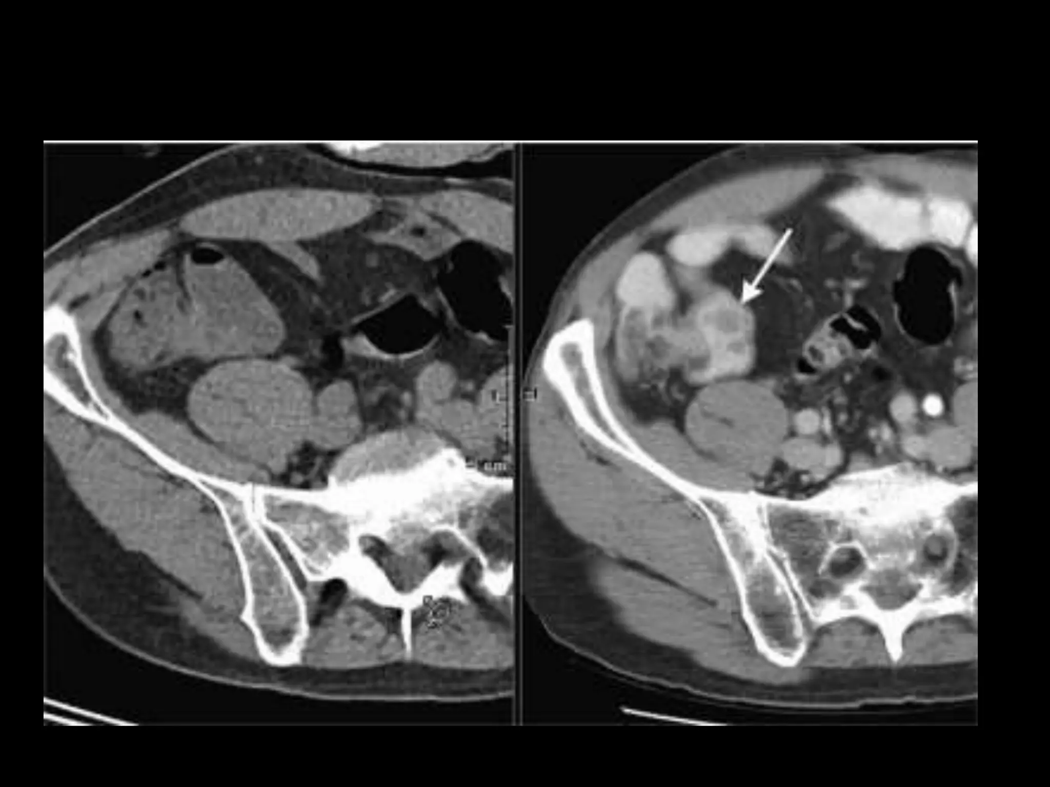 Abdominal CT scan made easy | PPTX