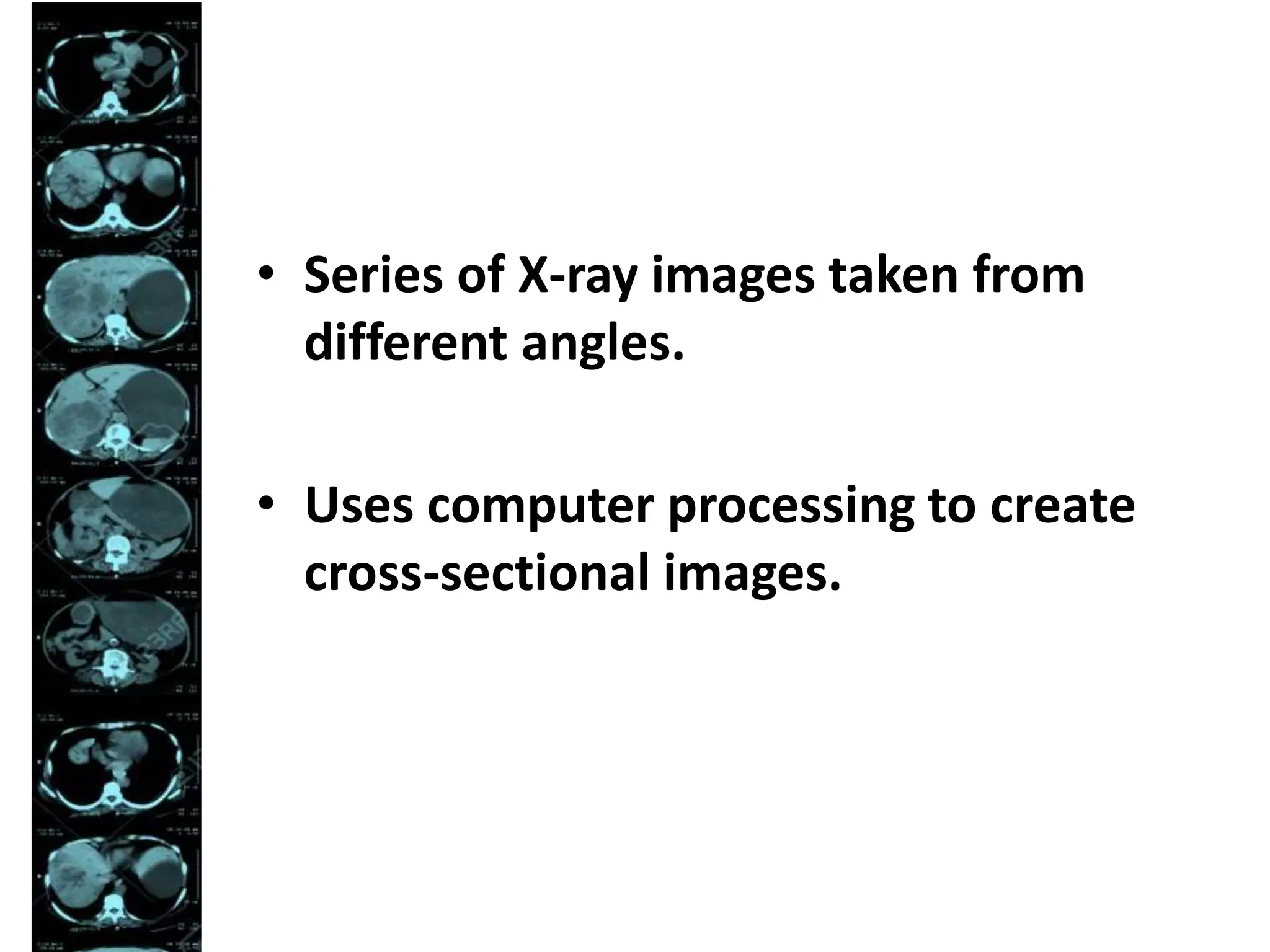 Abdominal CT scan made easy | PPTX
