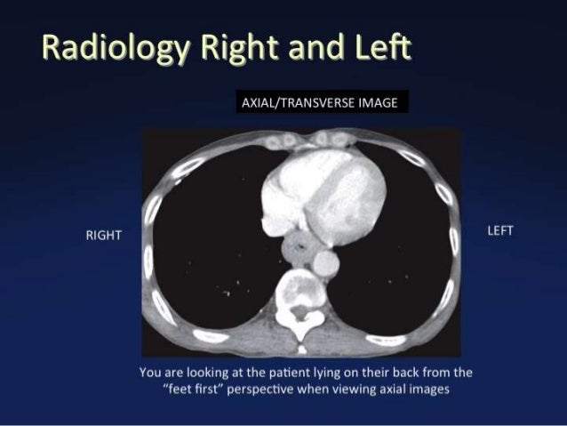 Abdominal CT scan made easy