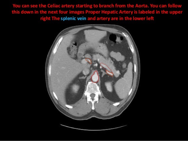 Abdominal CT scan made easy