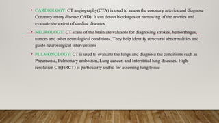 A presentation on CT scan for PG and UG | PPTX