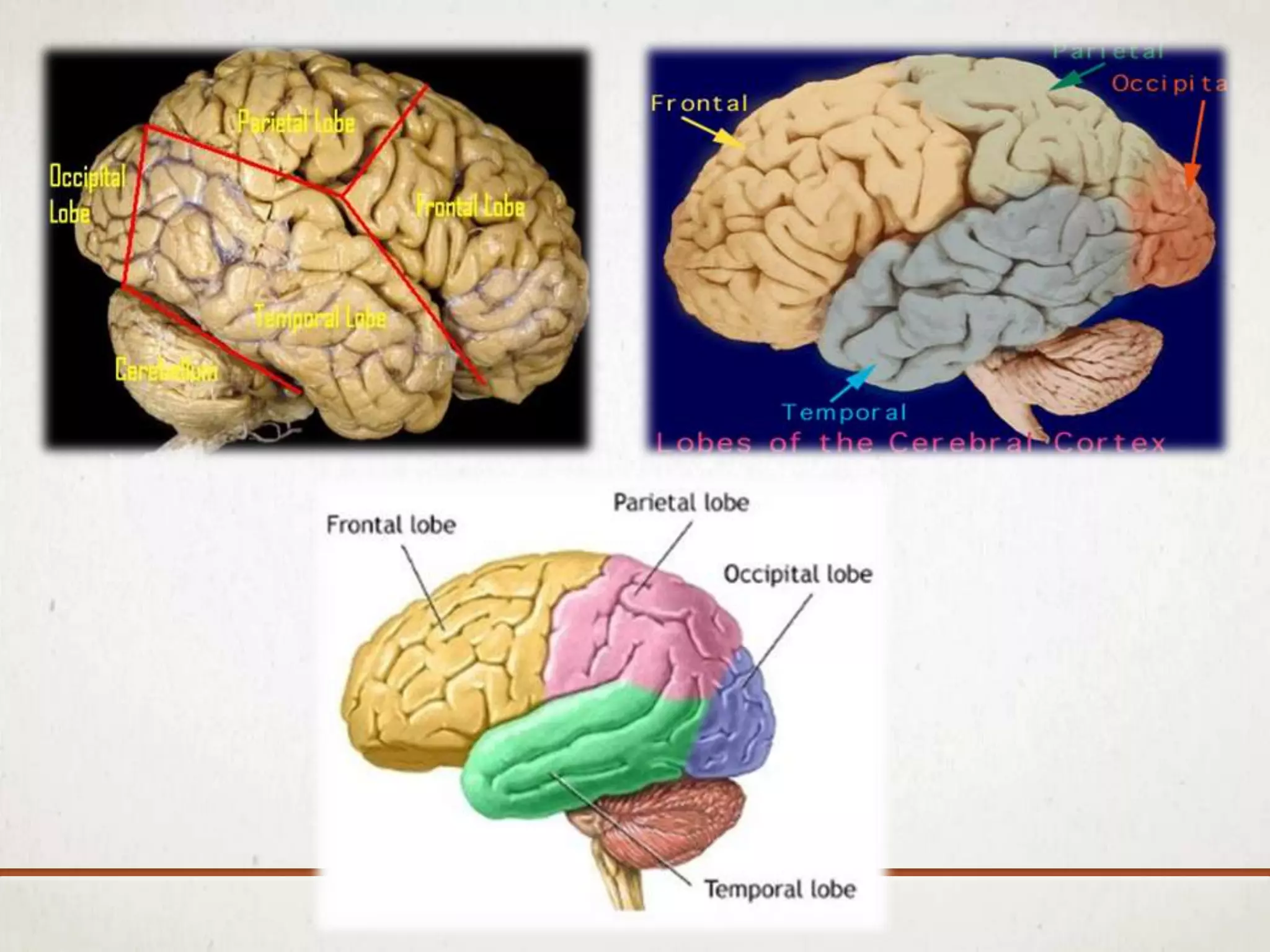 BRAIN CT SCAN | PPTX