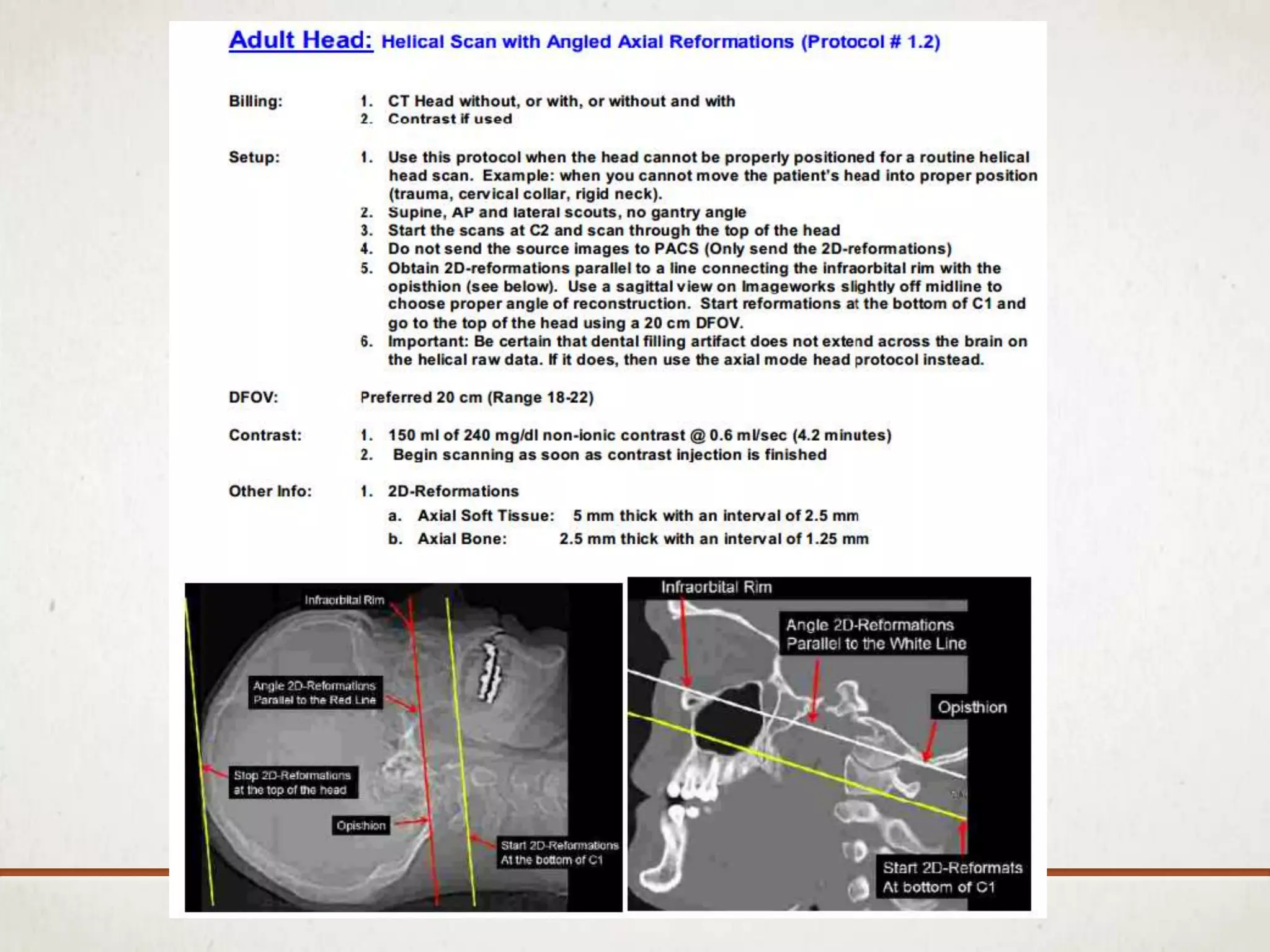 BRAIN CT SCAN | PPTX