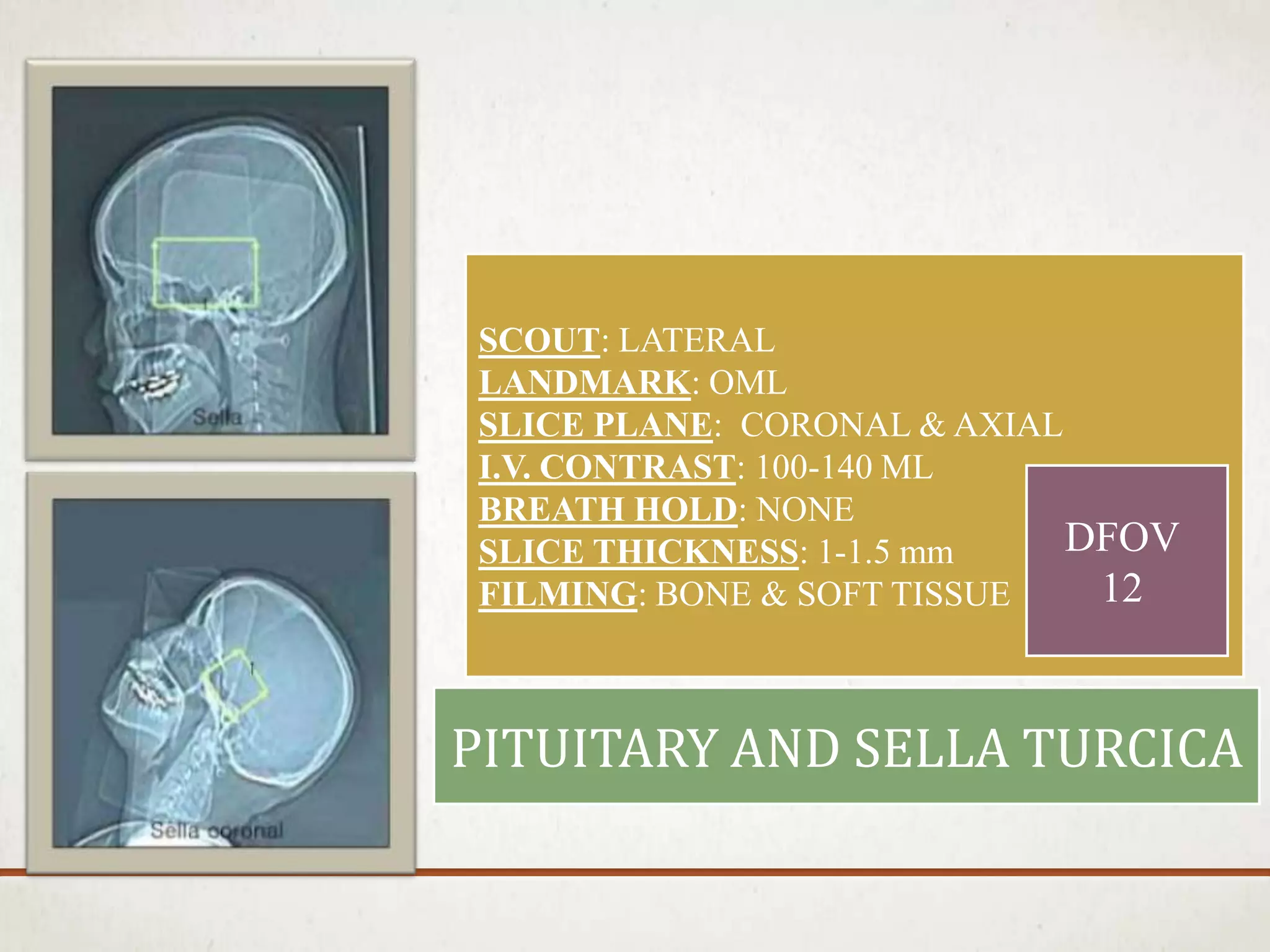BRAIN CT SCAN | PPTX