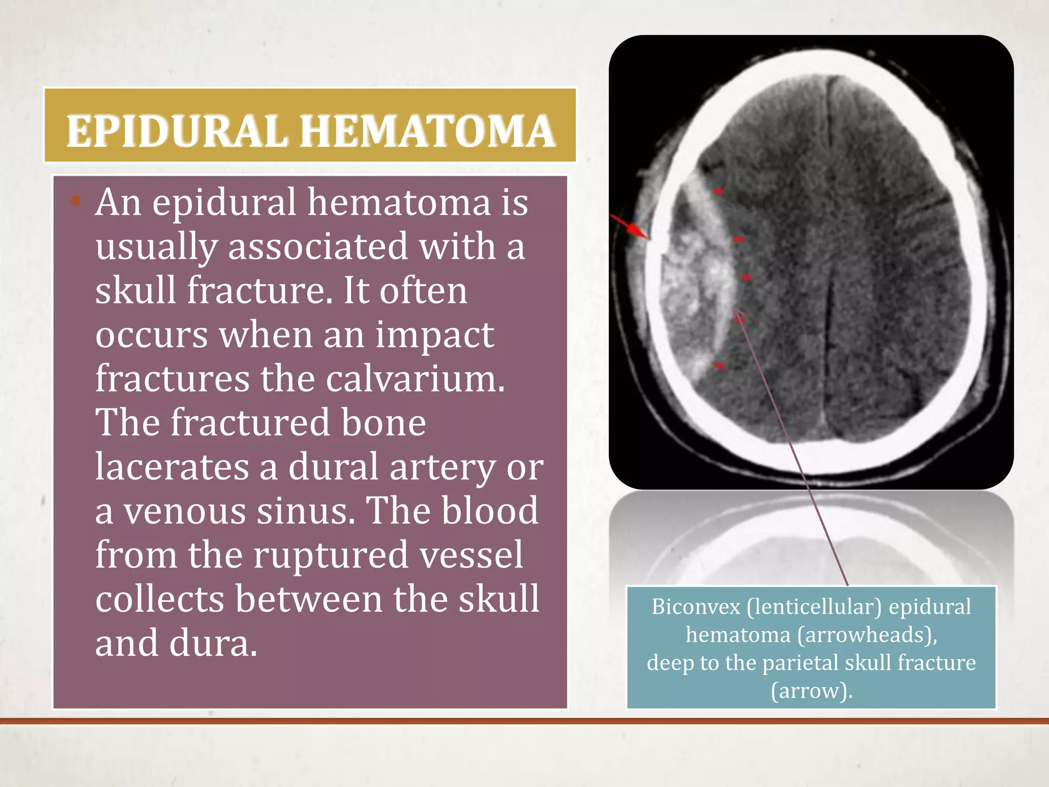 BRAIN CT SCAN | PPTX
