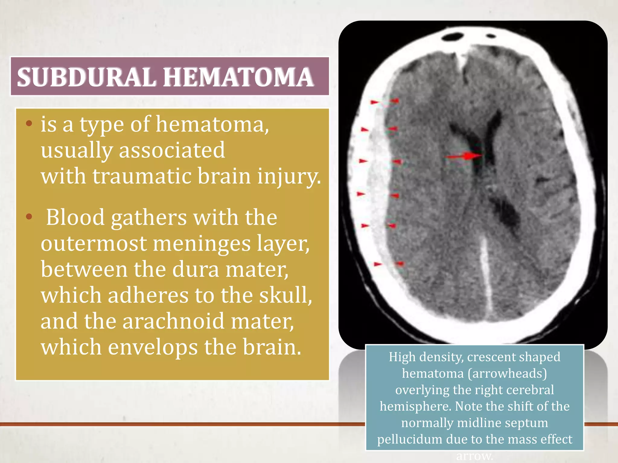 BRAIN CT SCAN | PPTX