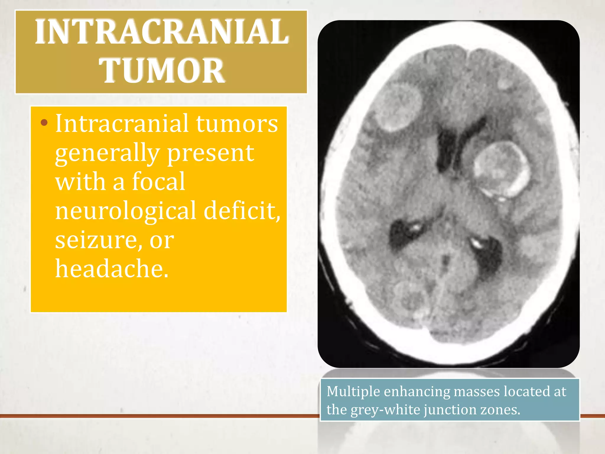 BRAIN CT SCAN | PPTX