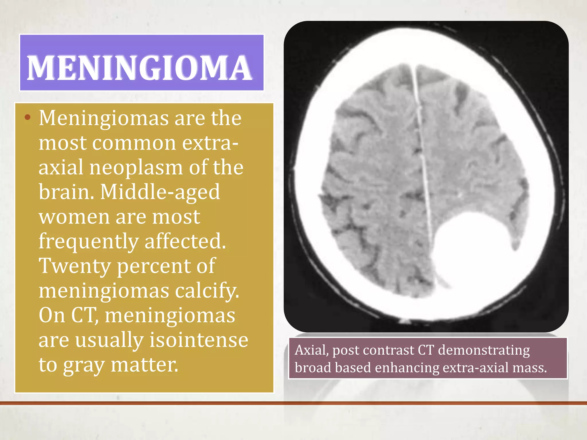 BRAIN CT SCAN | PPTX