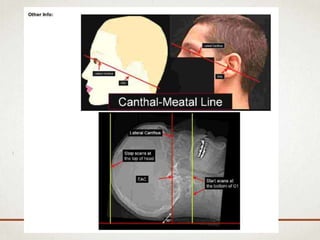 BRAIN CT SCAN | PPTX