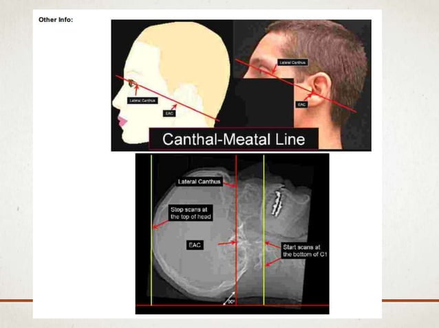 BRAIN CT SCAN | PPTX