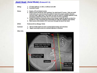 BRAIN CT SCAN | PPTX