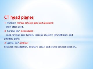 CT scan of the brain in stroke patients | PPTX
