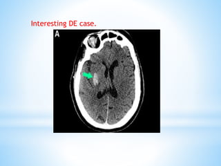 CT scan of the brain in stroke patients | PPTX
