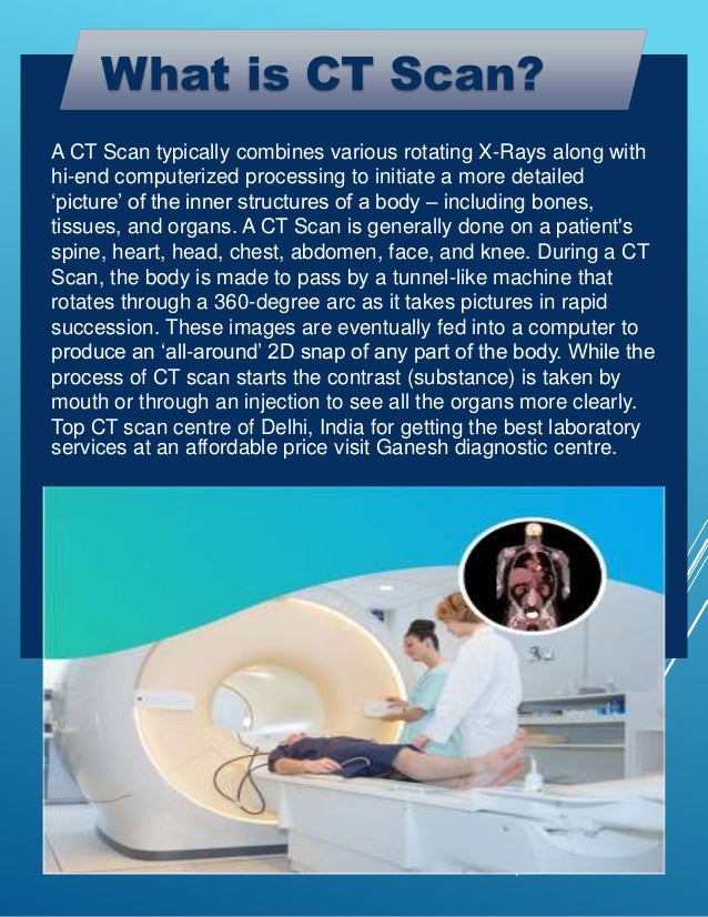 Best CT Scan Centre of Delhi | Ganesh Diagnostic & Imaging Centre Pvt Ltd | PDF
