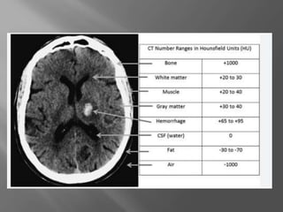 ct scan sandra ppt.pptx