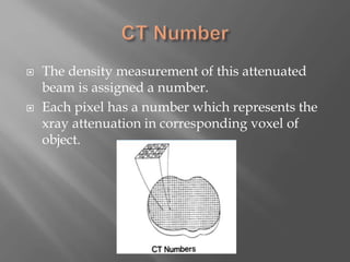 ct scan sandra ppt.pptx