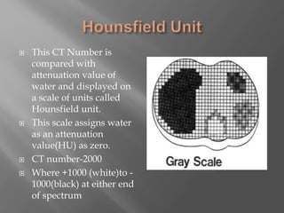 ct scan sandra ppt.pptx