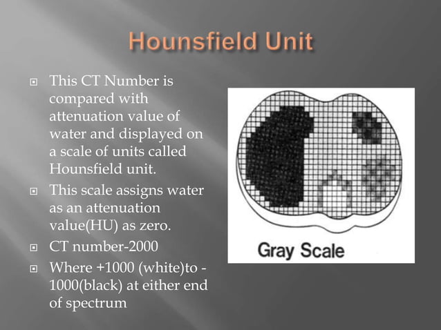 ct scan sandra ppt.pptx
