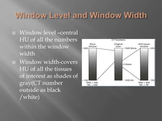 ct scan sandra ppt.pptx