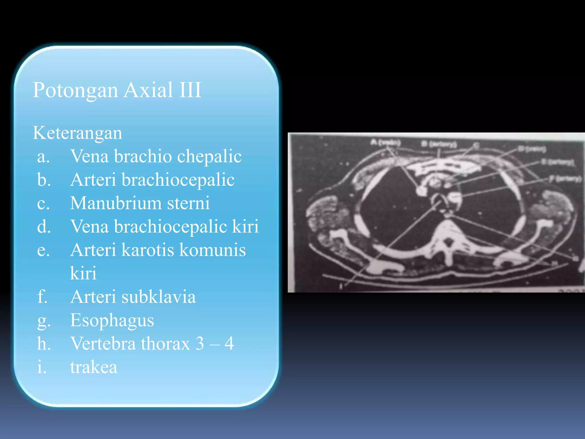 ppt Ct scan thorax pada klinis tumor hepar | PPTX